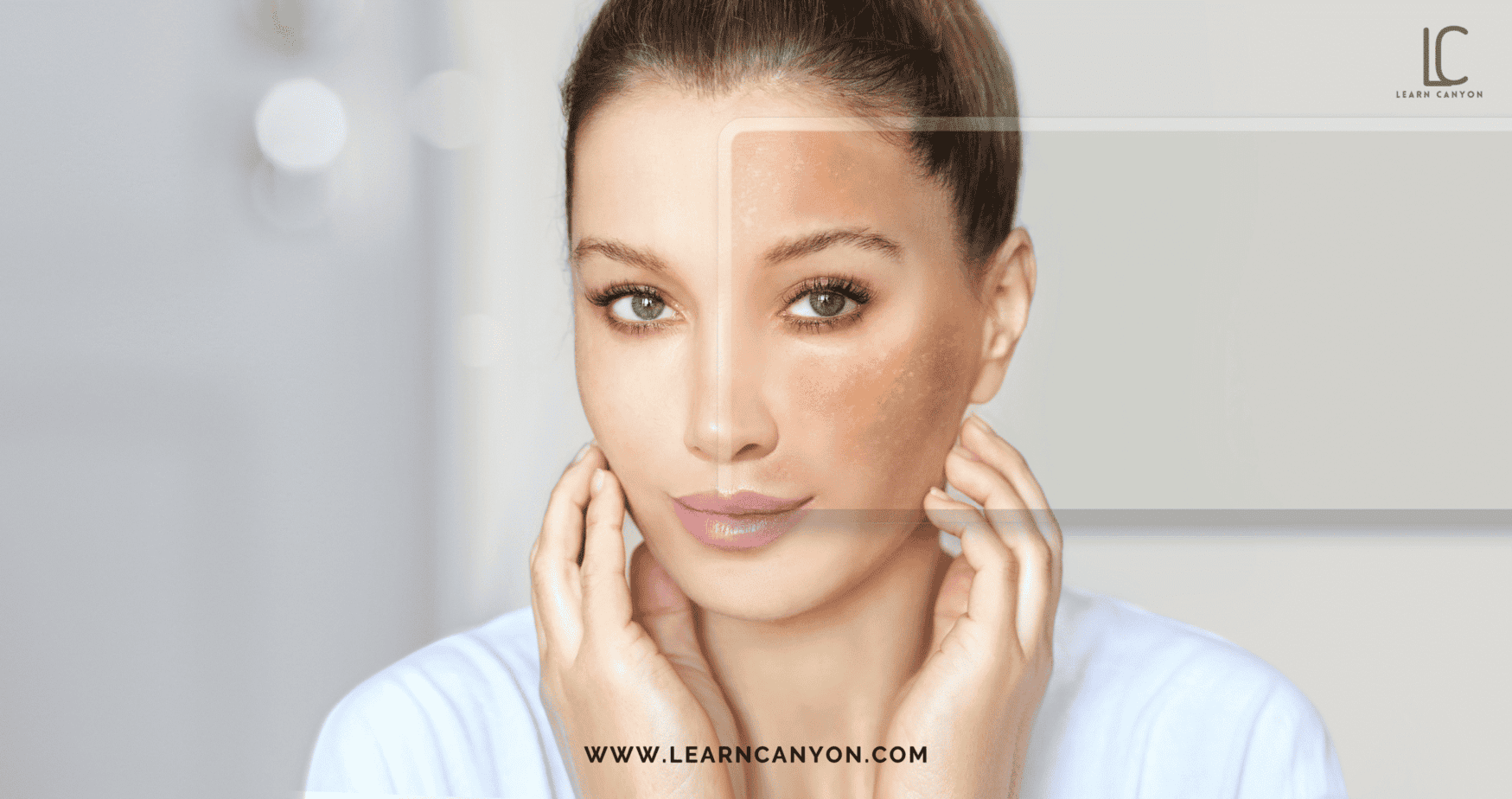 How To Get Rid Of Hyperpigmentation Naturally? Best Solution Is Here.